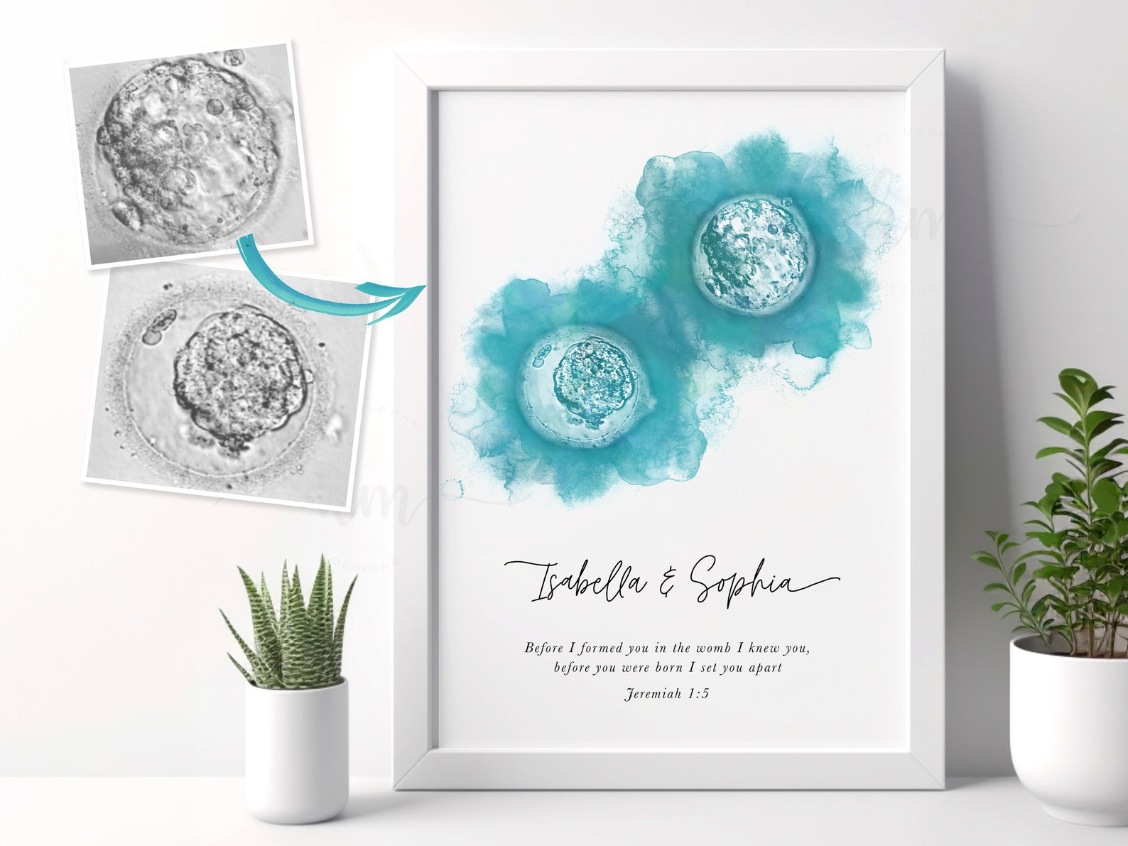 Hand Painted TWINS Embryo Art, Baby Shower Gift, Watercolor Baby ...
