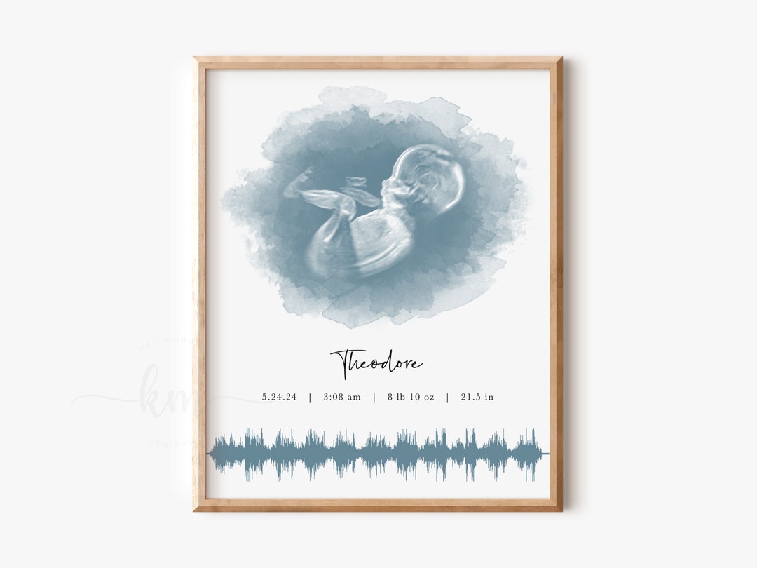 Watercolor Ultrasound Art, Baby Heartbeat Soundwave Print, Keepsake ...