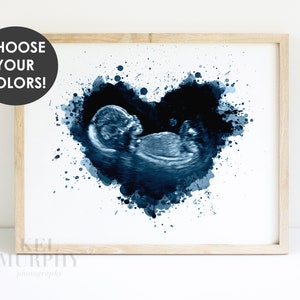 Ultrasound DIGITAL FILE Single Image Designs Custom Baby - Etsy