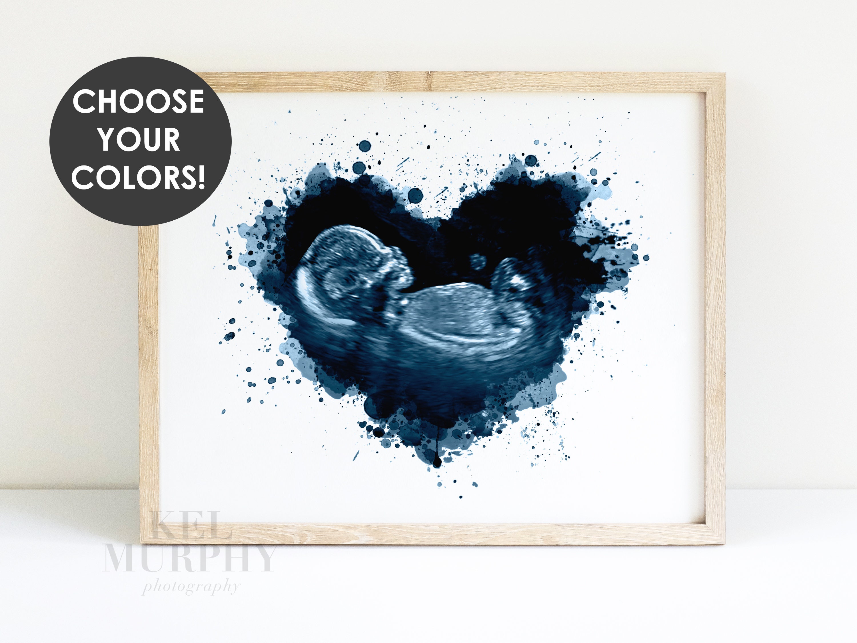 Ultrasound DIGITAL FILE Single Image Designs Custom Baby | Etsy