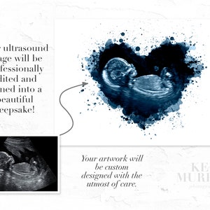 Ultrasound Baby Heartbeat Soundwave Art Heart Watercolor - Etsy