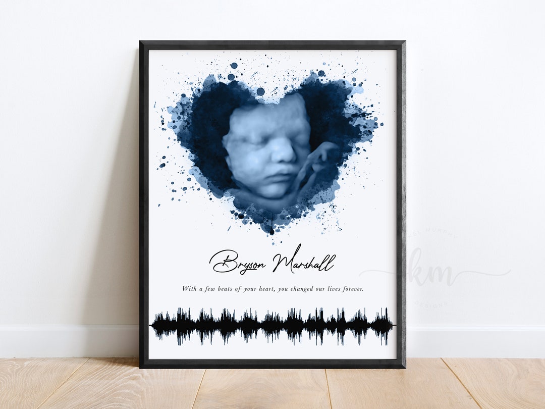 Watercolor Ultrasound Art With Baby's Heartbeat, Soundwave Art, Custom ...