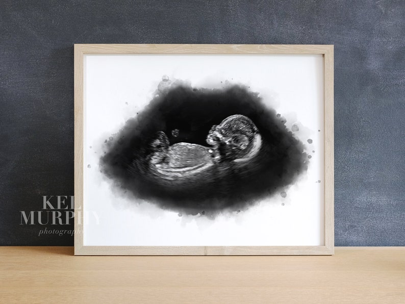 Watercolor Ultrasound Art Print Personalized Sonogram Custom | Etsy