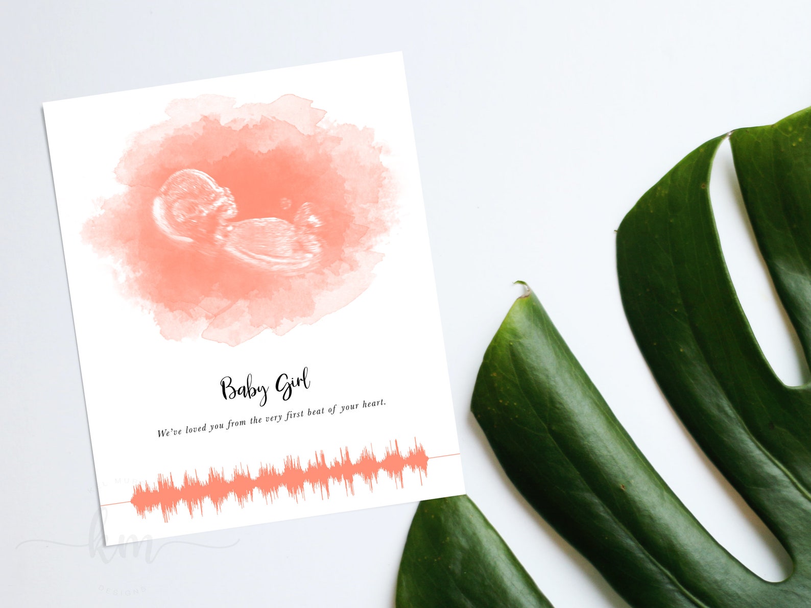 Watercolor Ultrasound Art With Heartbeat Soundwave Baby - Etsy