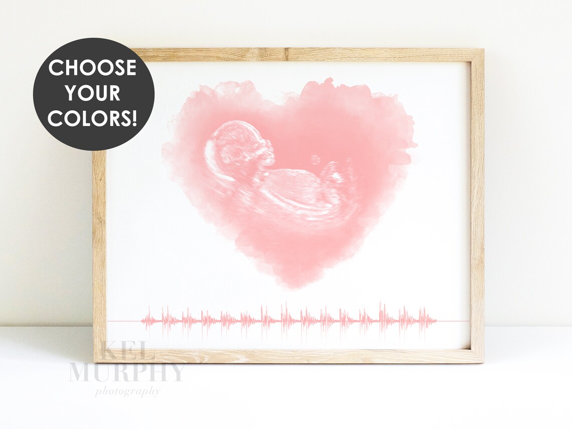 Ultrasound DIGITAL FILE Multiple Image Designs or Heartbeat - Etsy