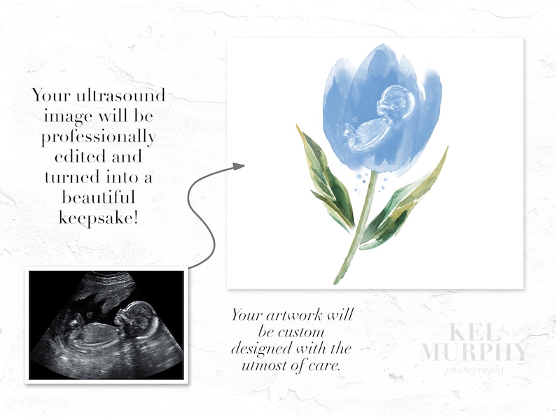 Tulip Watercolor Ultrasound Art, Custom New Mom Gift, Sonogram Print ...