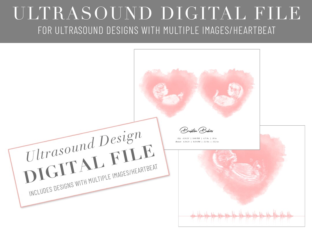 Ultrasound DIGITAL FILE - Multiple Image Designs or Heartbeat! Custom ...