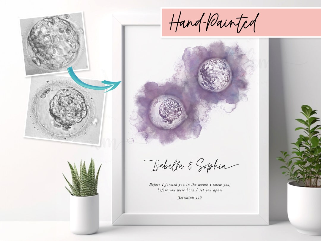 Hand Painted TWINS Embryo Art, Baby Shower Gift, Watercolor Baby ...