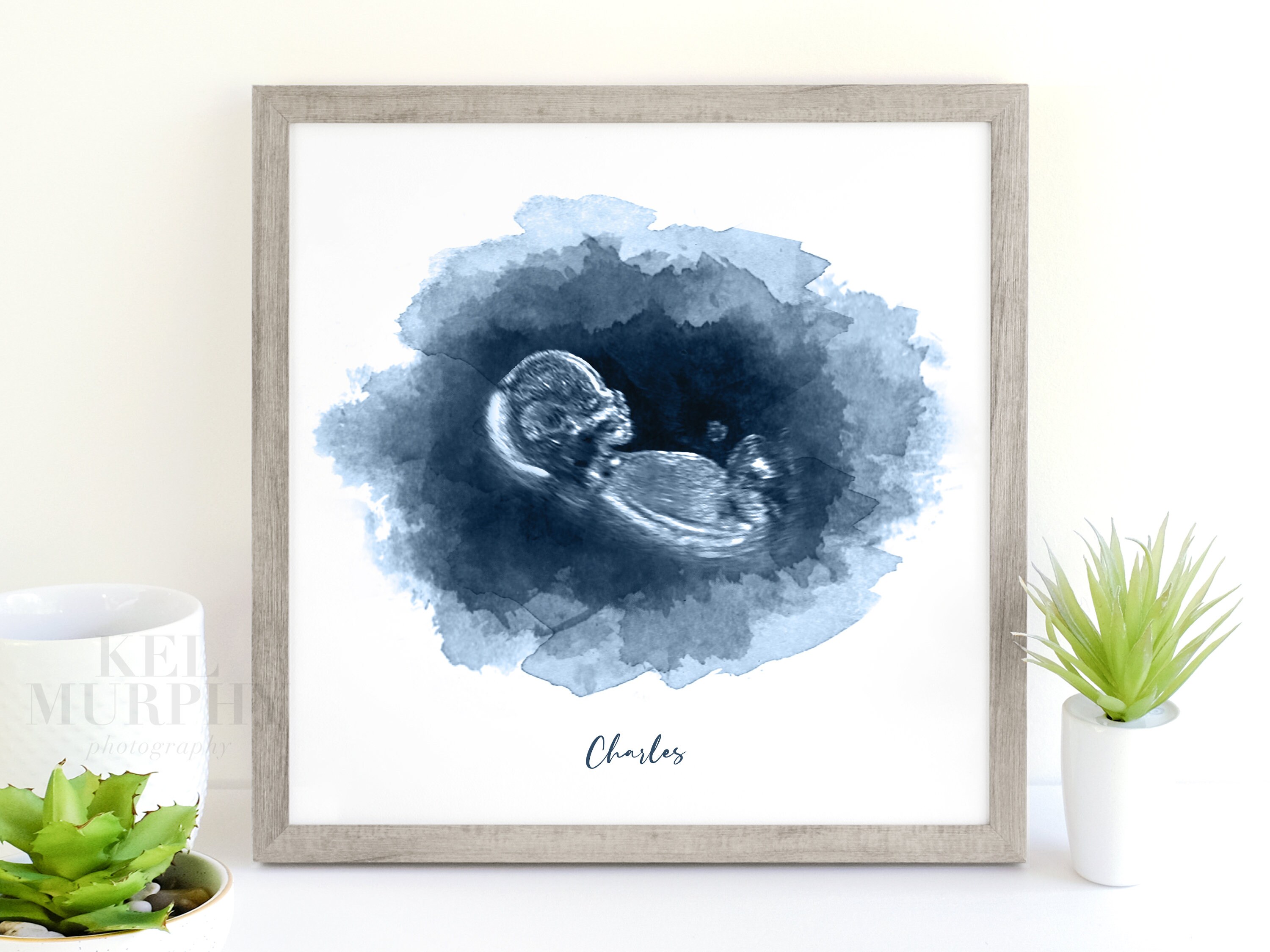 Baby Ultrasound Watercolor Art Custom Sonogram Print Shower | Etsy