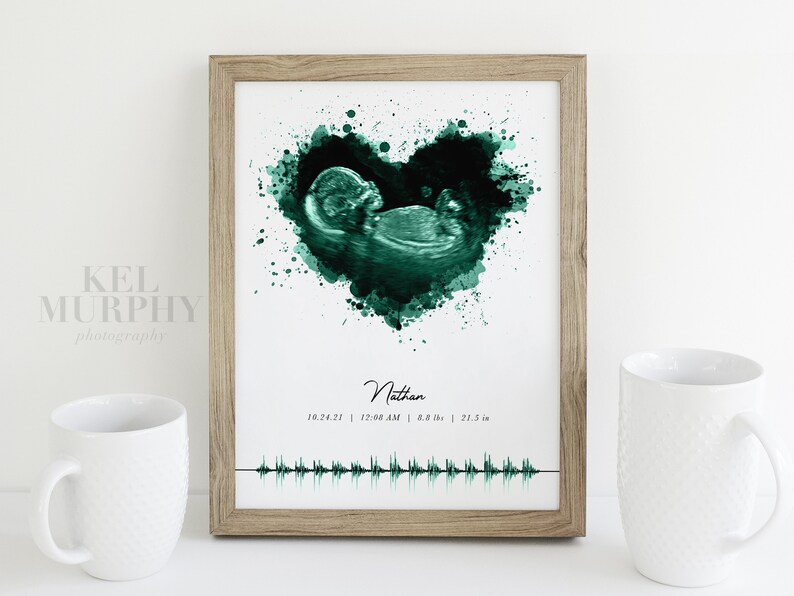 Ultrasound Baby Heartbeat Soundwave Art Heart Watercolor - Etsy