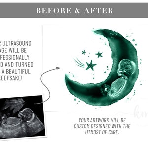 Baby Heartbeat Soundwave Ultrasound Art, Moon Stars Watercolor Sonogram ...