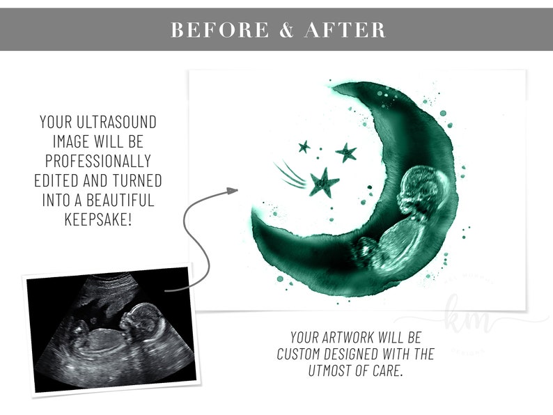 Baby Heartbeat Soundwave Ultrasound Art, Moon Stars Watercolor Sonogram ...