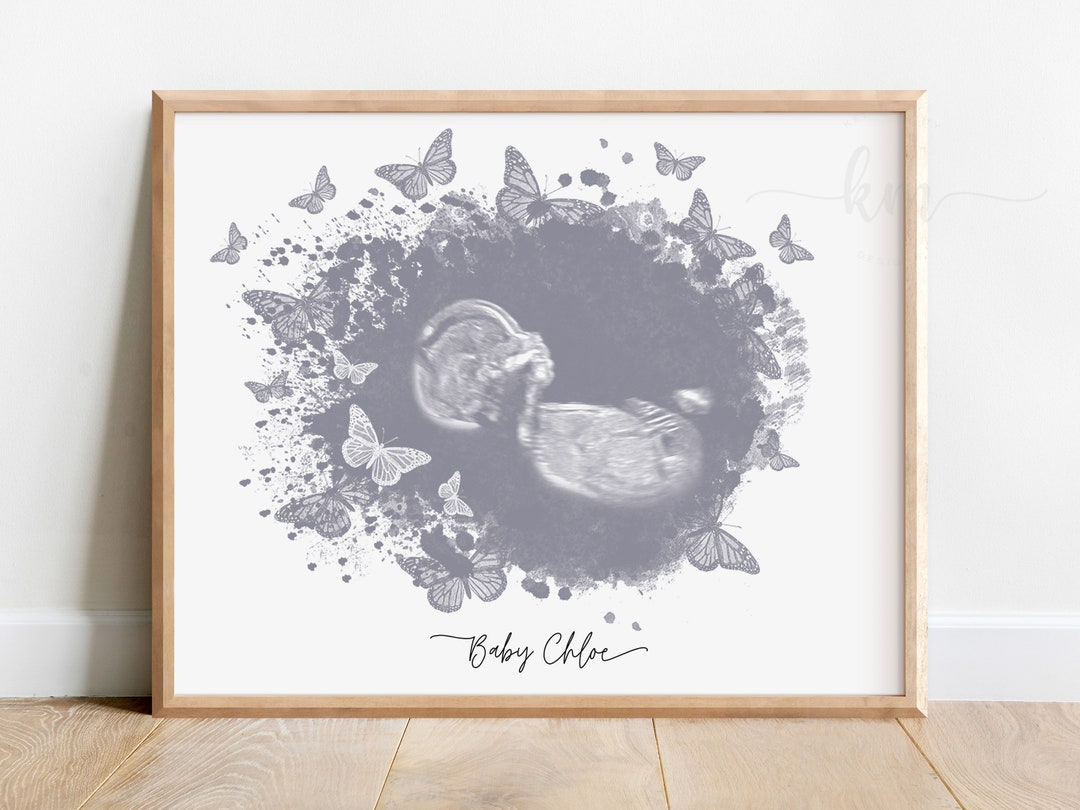 Butterfly Watercolor Ultrasound Art, Infant Loss Keepsake, Baby ...