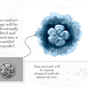IVF Embryo Art, Watercolor Fertility Print, Baby Keepsake Art, Custom ...