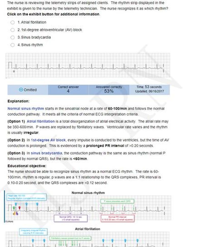 ECG EKG Practice Test, Nursing Medical Staff Study Guide (PDF) - Etsy