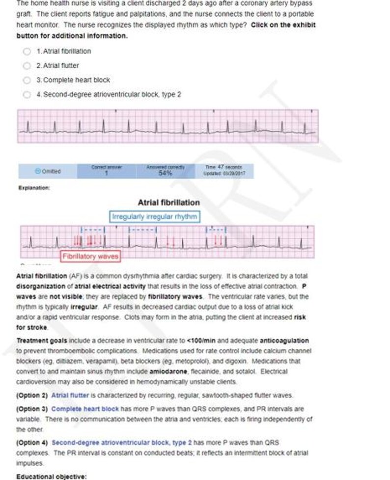 ECG EKG Practice Test, Nursing Medical Staff Study Guide (PDF) - Etsy