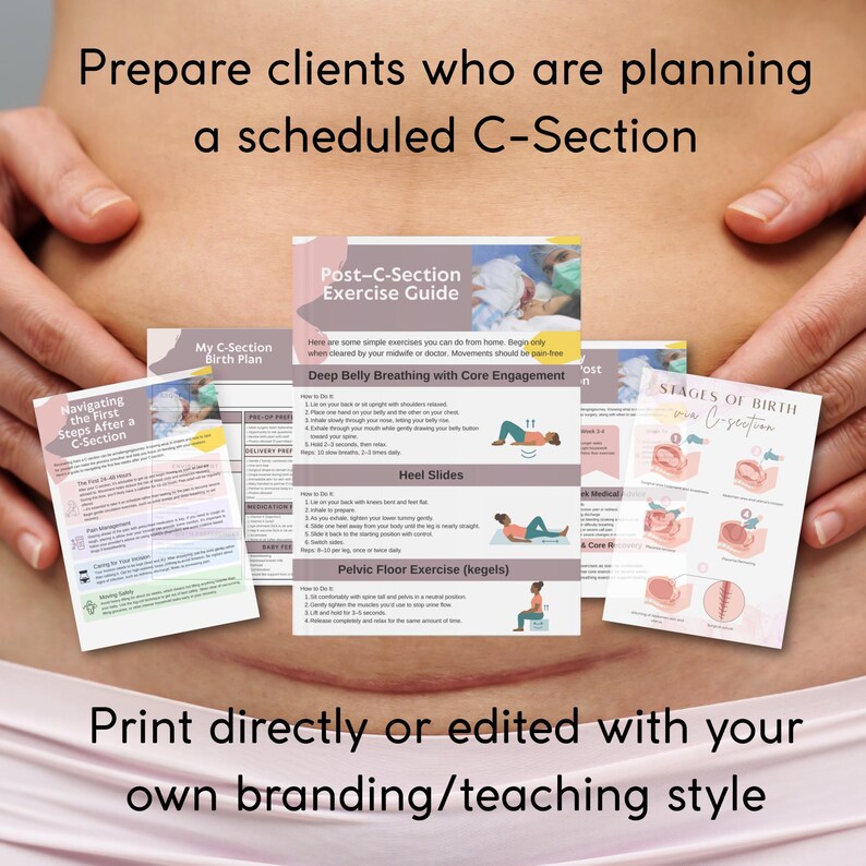 C-section Recovery & Birth Plan Printable Bundle | Postpartum Exercise ...