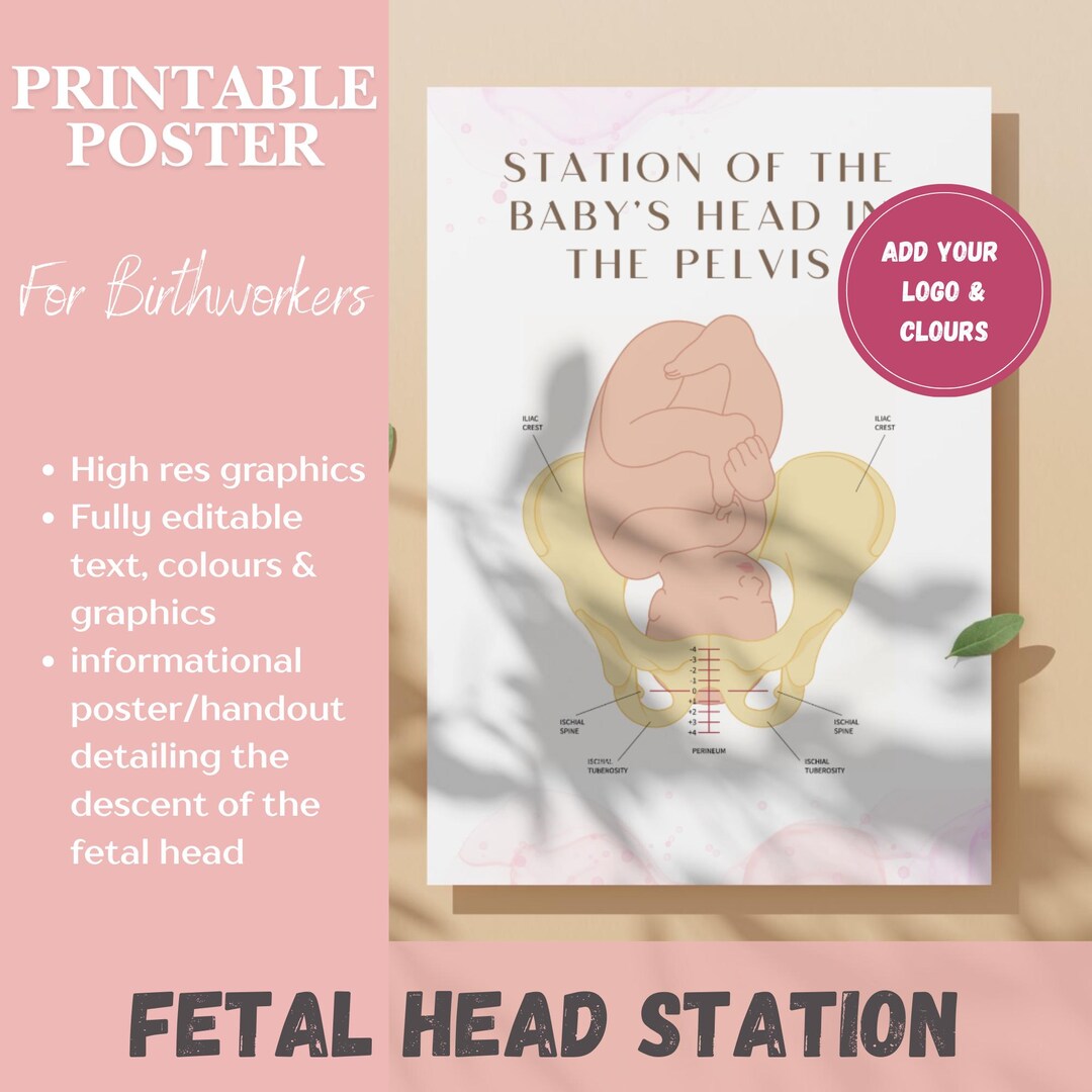 Fetal Station & Descent Poster | Editable Canva Template PDF | Doulas ...