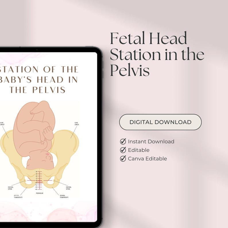 Fetal Station & Descent Poster | Editable Canva Template PDF | Doulas ...