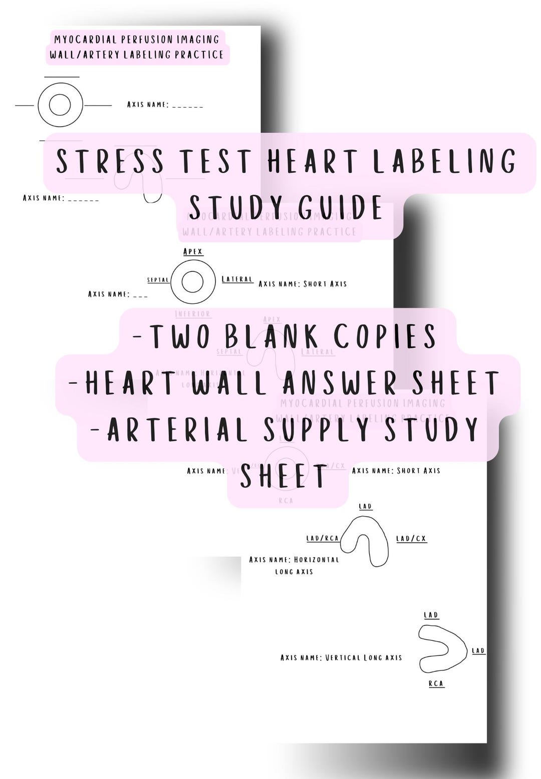 Nuc Med Study Guide - Myocardial Perfusion Imaging Walls/arteries ...