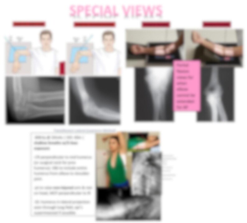 Forearm, Elbow, Humerus X-ray Positioning Cheat Sheet - Etsy