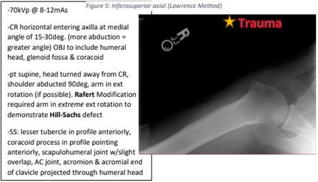 Shoulder, Scapula, Clavicle and AC Joints X-ray Positioning Cheat Sheet ...