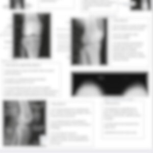 Tib/fib, Knee and Patella X-ray Positioning Cheat Sheet - Etsy