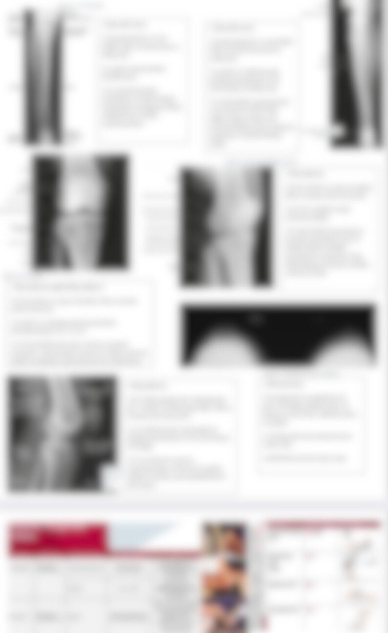 Tib/fib, Knee and Patella X-ray Positioning Cheat Sheet - Etsy