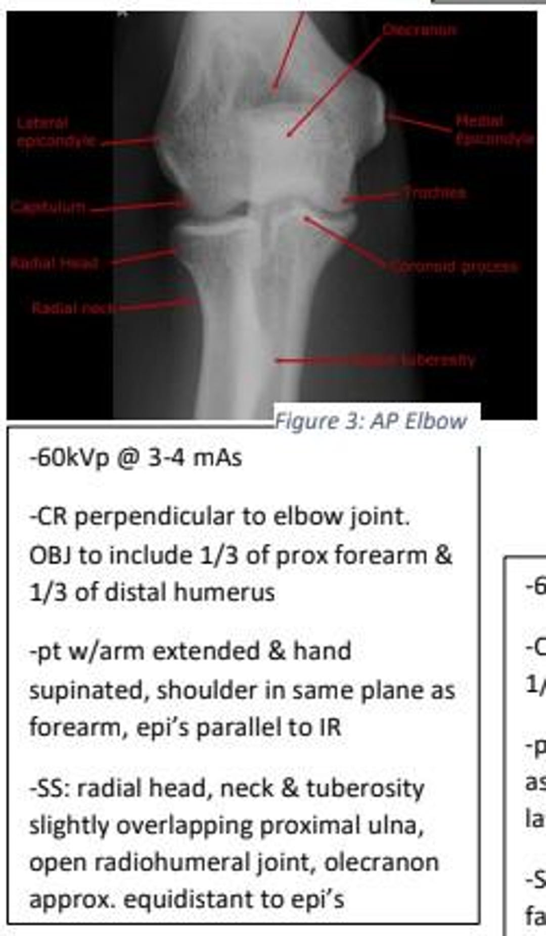 Forearm, Elbow, Humerus X-ray Positioning Cheat Sheet - Etsy