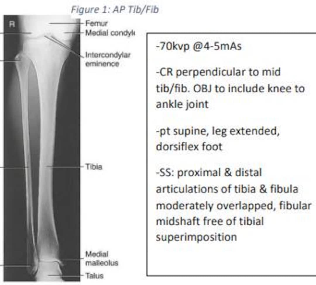 Tib/fib, Knee and Patella X-ray Positioning Cheat Sheet - Etsy