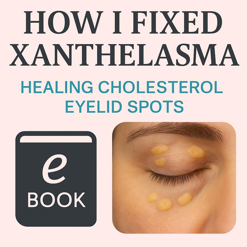 Xanthelasma Recovery Guide | How I Cleared Cholesterol Eyelid Spots ...