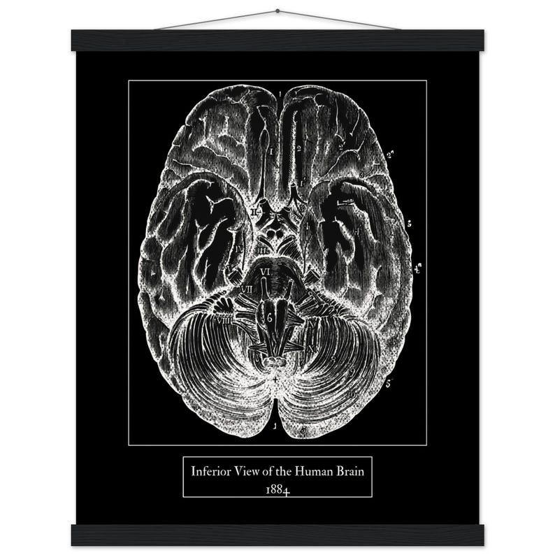 Vintage Brain Anatomy Print | Black and White Inverted Museum-quality ...