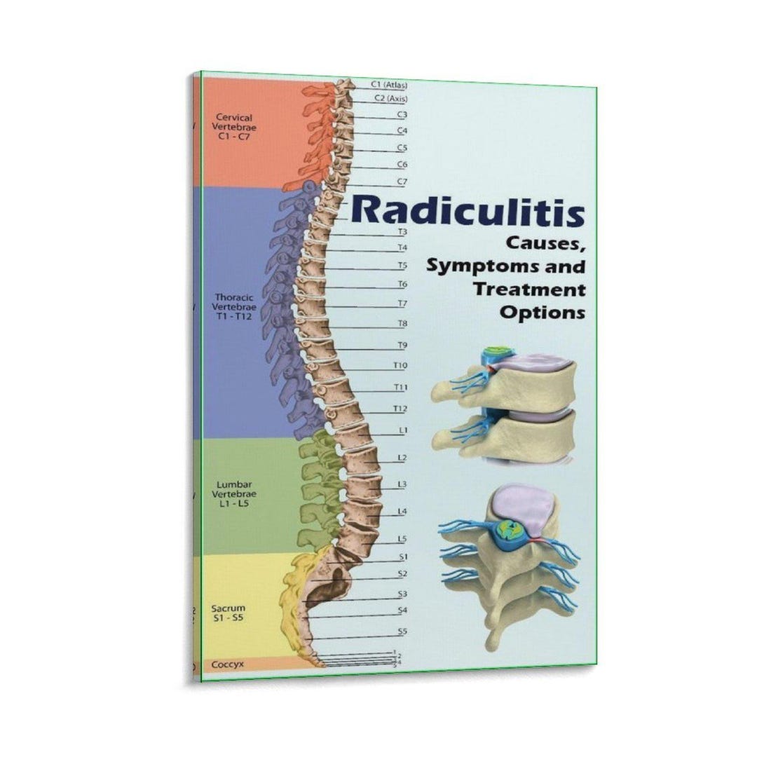 Diagram of the Spine and Intervertebral Disc Canvas Art Poster and Wall ...
