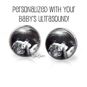 Ultrasound Cuff Links - Custom Baby Photo Sonogram Cufflinks - Gifts ...