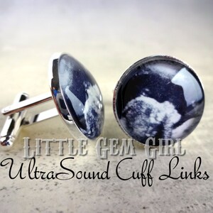 Ultrasound Cuff Links - Custom Baby Photo Sonogram Cufflinks - Gifts ...
