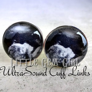 Ultrasound Cuff Links - Custom Baby Photo Sonogram Cufflinks - Gifts ...