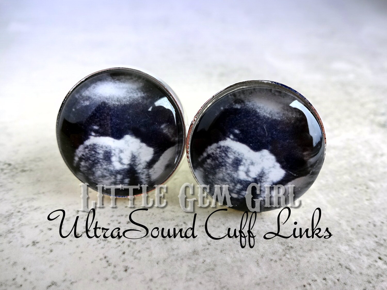 Ultrasound Cuff Links Custom Baby Photo Cuff Links Baby | Etsy
