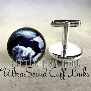 Ultrasound Cuff Links - Custom Baby Photo Sonogram Cufflinks - Gifts ...