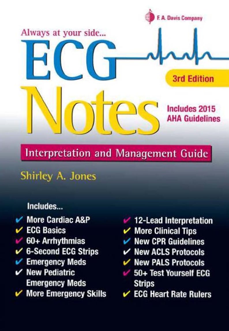 ECG Notes Interpretation and Management Guide by Shirley A. Jones - Etsy