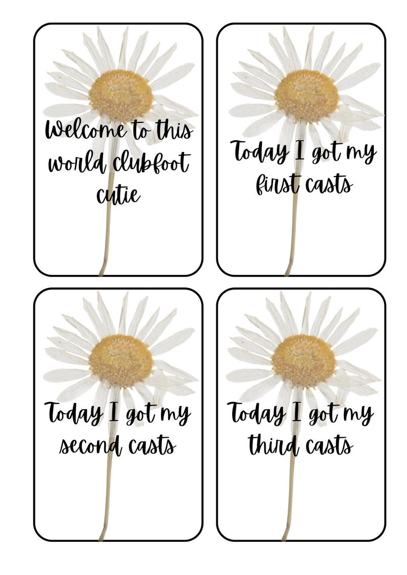 Printable Clubfoot Milestone Cards - Celebrate Clubfoot Cuties ...