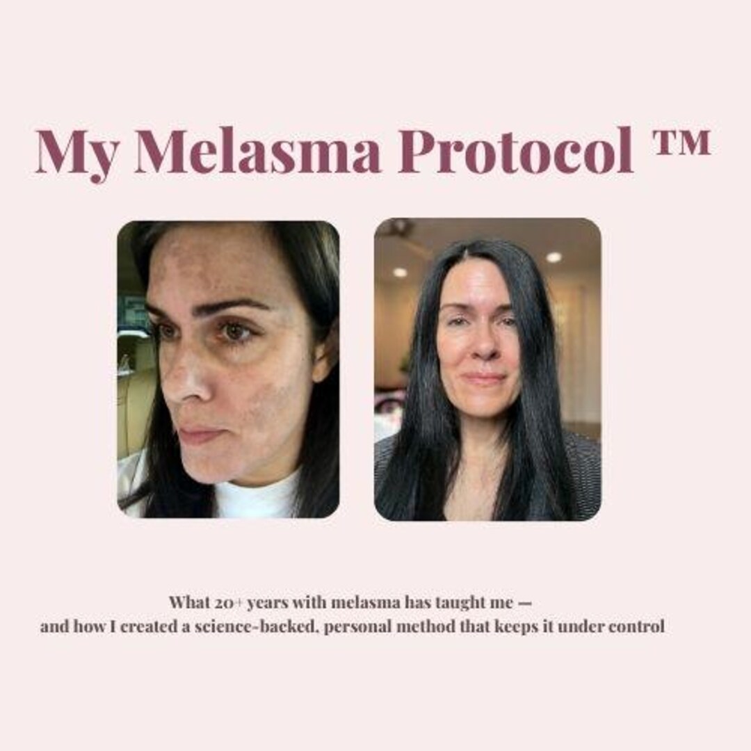 Get My Melasma Protocol™ Now - My Personal Method for Fading Melasma ...