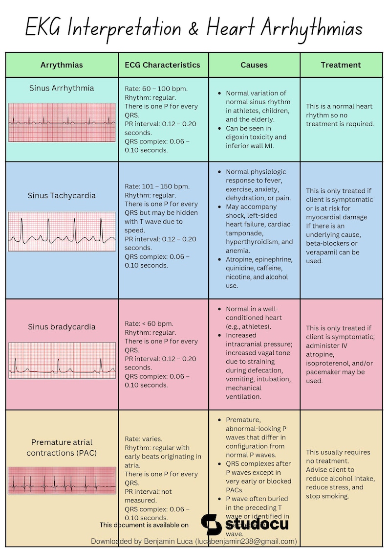 EKG Interpretation & Arrhythmias Study Guide 2026 | ECG Causes and ...