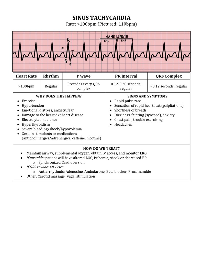 EKG Interpretation Guide PDF 2026 | 6 Steps, Heart Blocks & Rhythm ...