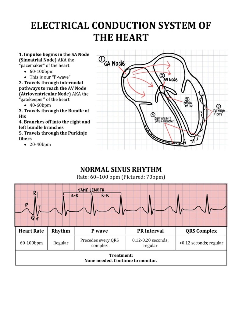 EKG Interpretation Guide PDF 2026 | 6 Steps, Heart Blocks & Rhythm ...