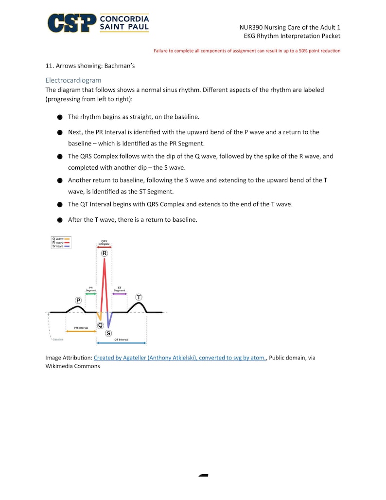 EKG Rhythm Interpretation Packet PDF 2026 | ECG Lead Placement ...