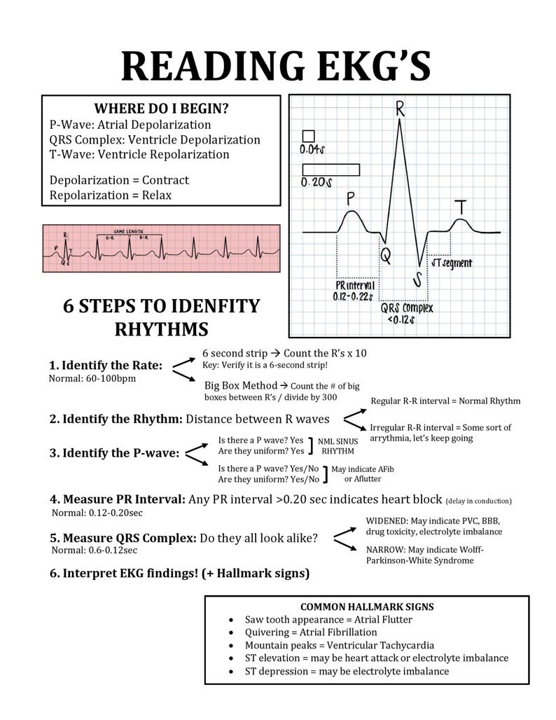 EKG Interpretation Guide PDF 2026 | 6 Steps, Heart Blocks & Rhythm ...