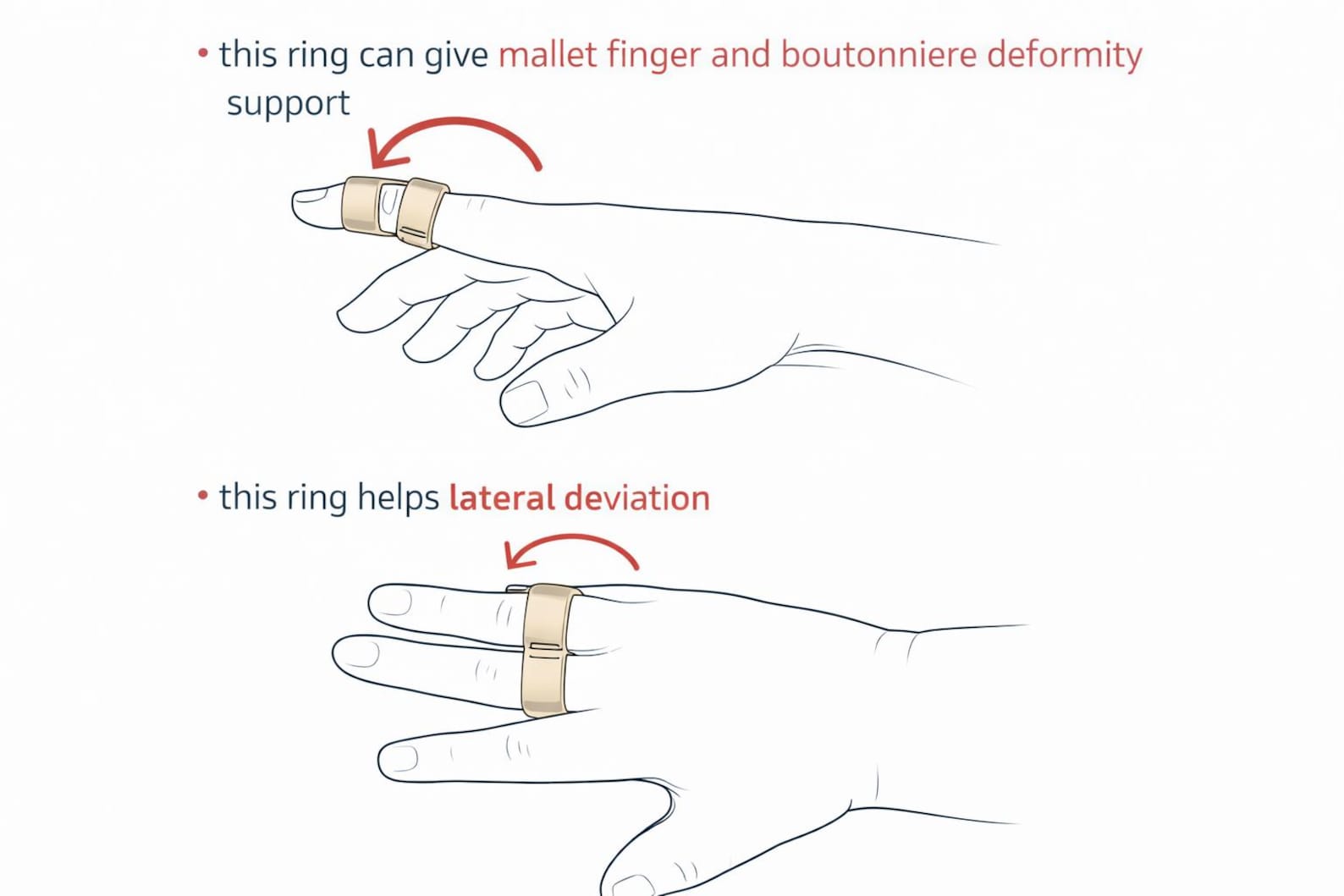 Sterling Silver Full Finger Splint Ring, Arthritis Support, EDS Brace ...