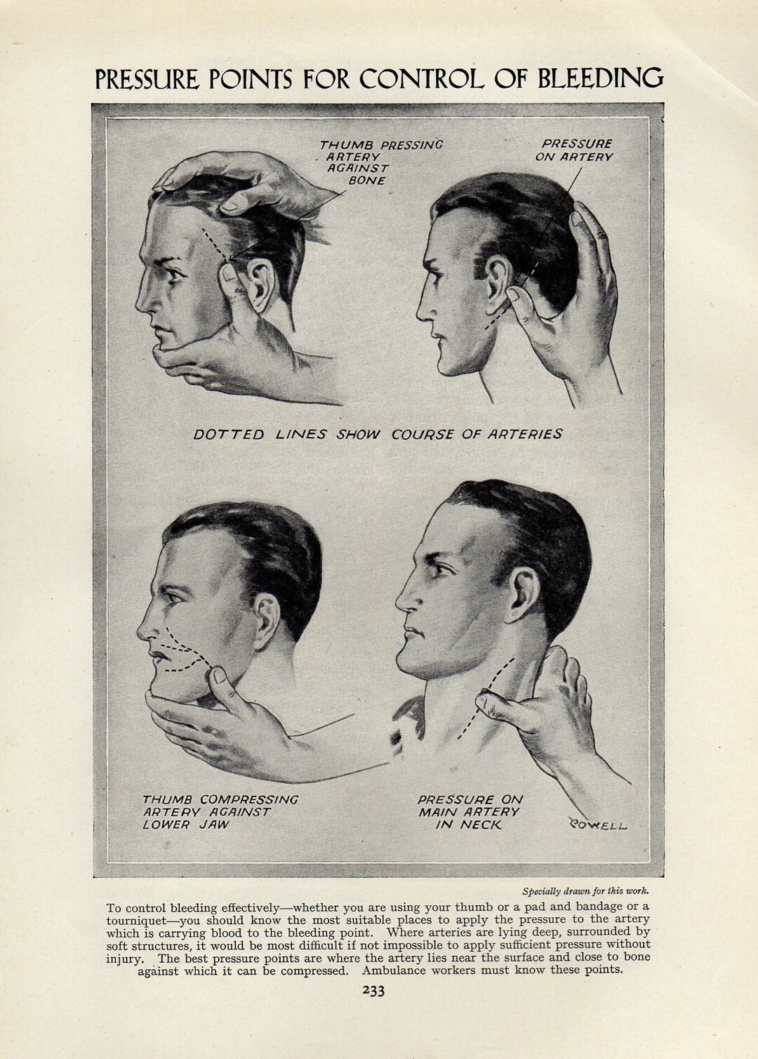1940 Pressure Points for Control of Bleeding Antique Human Anatomy ...