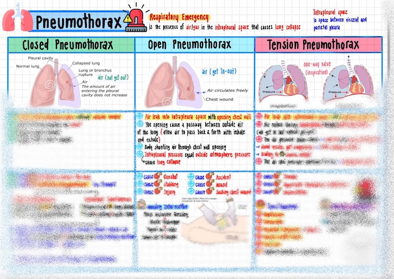 Pneumothorax & Chest Tube Nursing Study Guide - Etsy