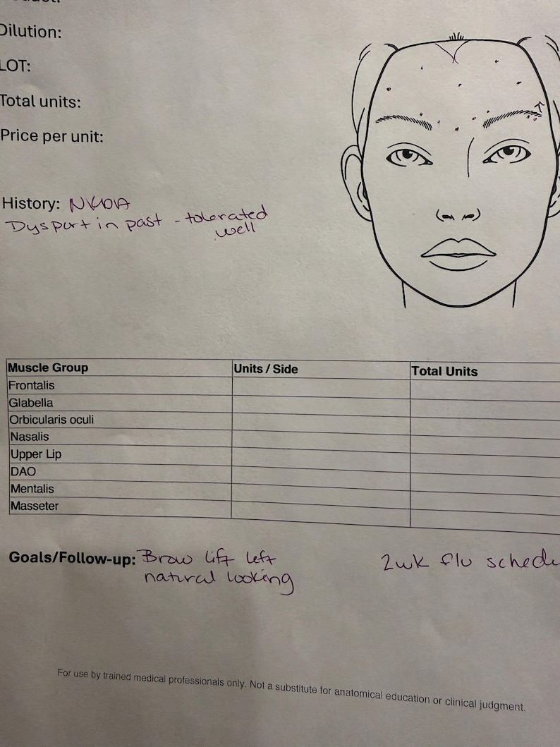 Neurotoxin Injection Face Chart | Patient Facial Mapping PDF | Botox ...